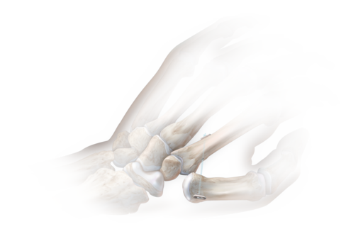 Arthrex - Helping Surgeons Treat Their Patients Better™