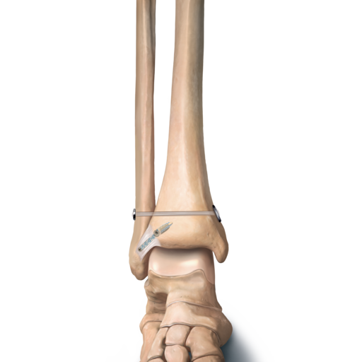 Arthrex - Helping Surgeons Treat Their Patients Better™