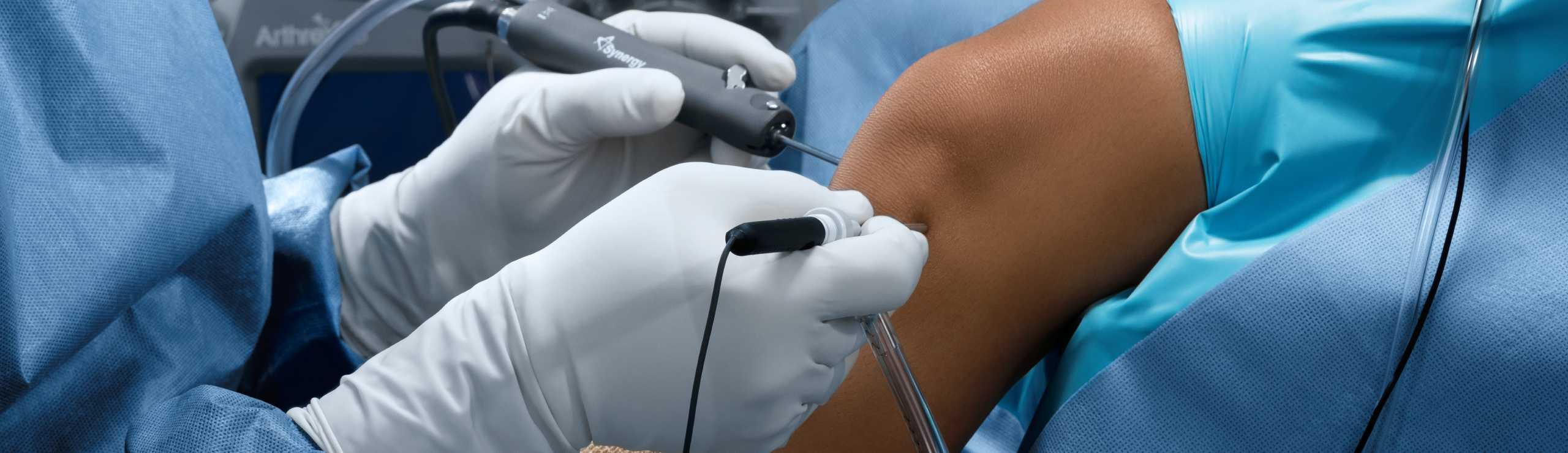 Nano Operative Arthroscopy System | Arthrex – Synergy