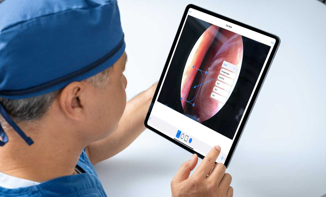 Create Post-op Report