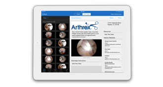 Synergy Imaging and Resection | Arthrex