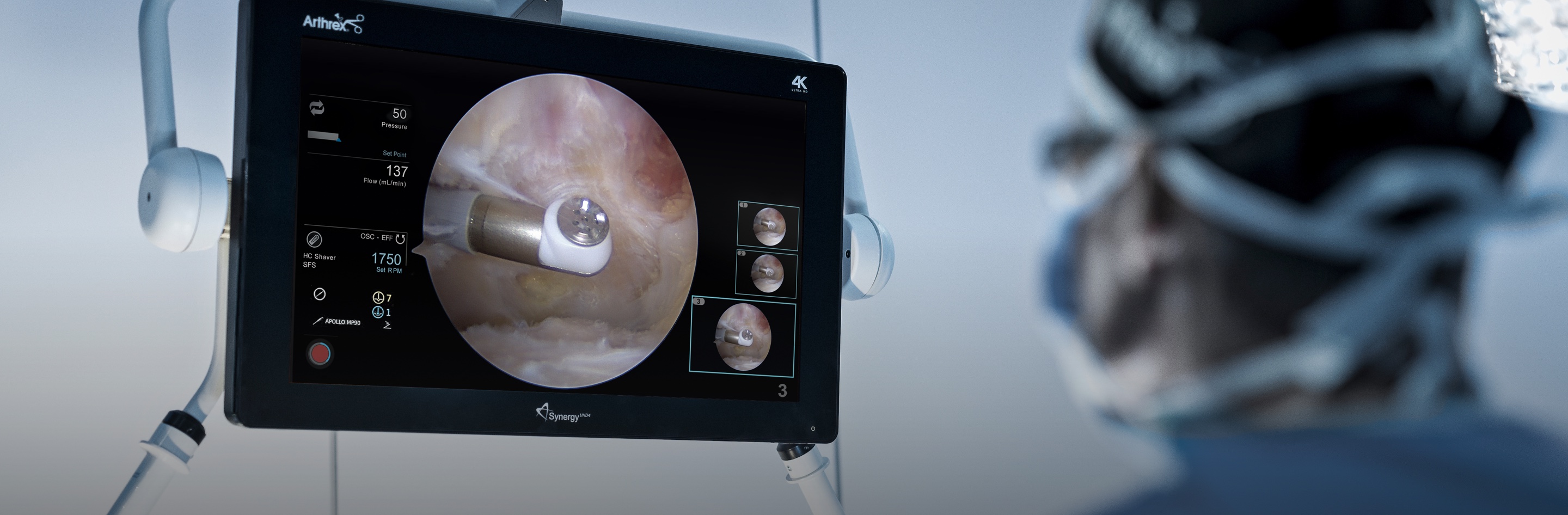 Synergy Imaging and Resection | Arthrex